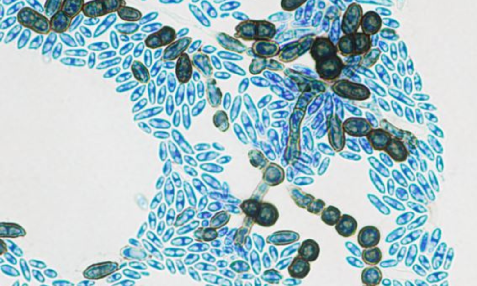 Mould Treatment – Microguard Biotech