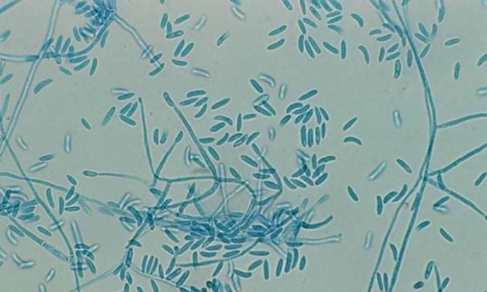 Mould Treatment – Microguard Biotech